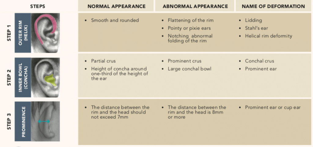 Ear Molding - Non-Surgical Ear Correction | Kids Clinic Singapore